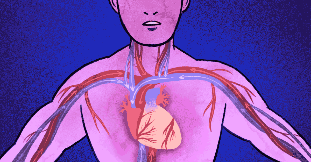 What Is Coronary Artery Disease (CAD) and How Is It Treated?